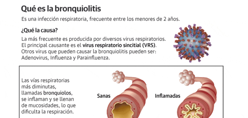 Sanidad: La oleada de bronquiolitis en niños obliga a reforzar la ...